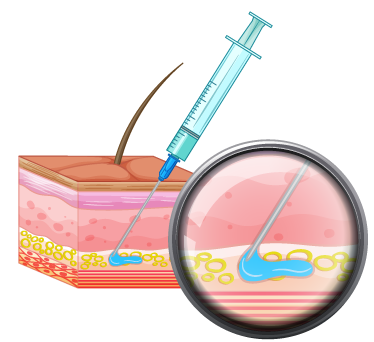 Tratamiento para la anticoagulación – Los Comuneros